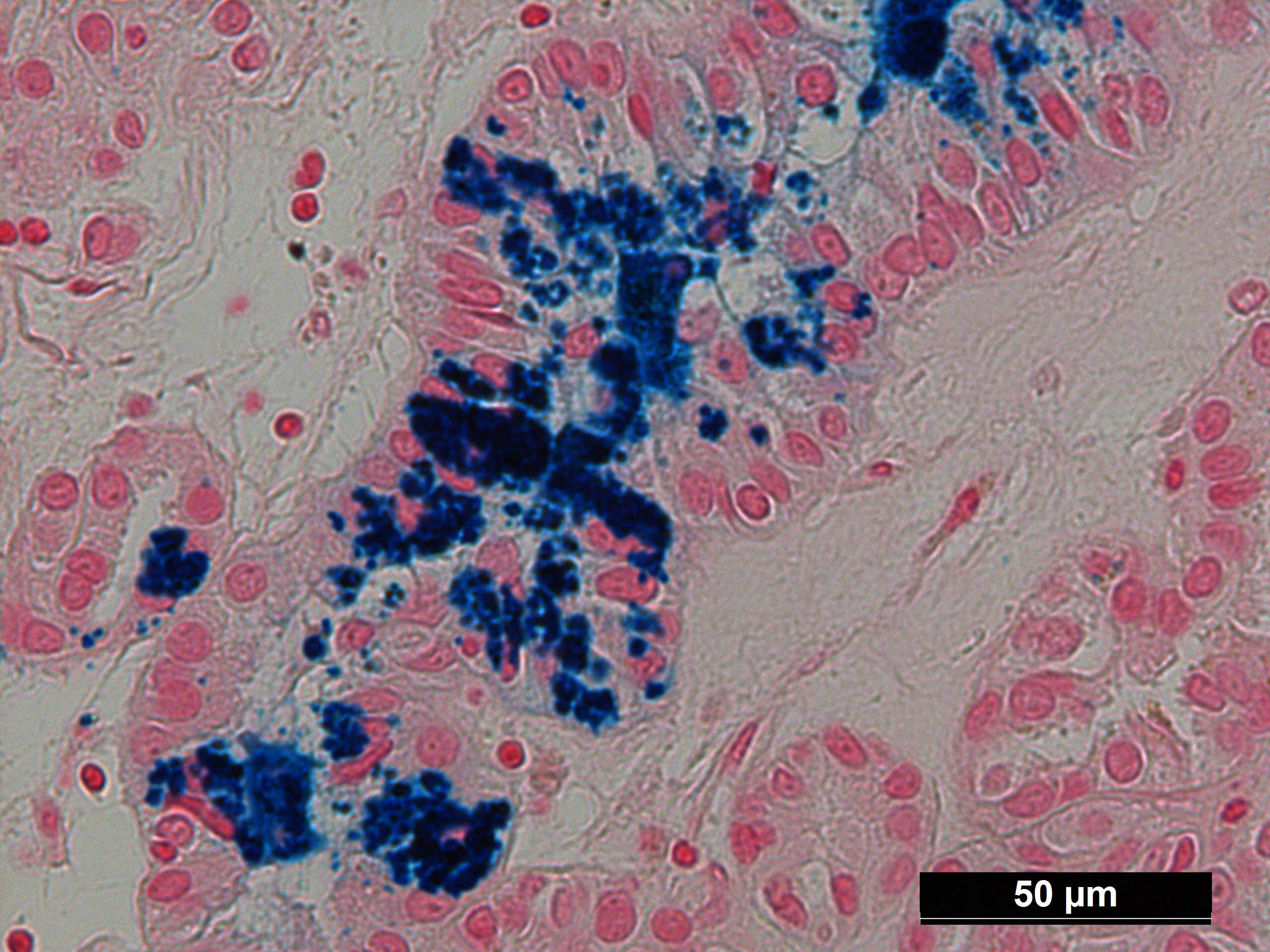 VitroView™ Prussian Blue Stain Kit