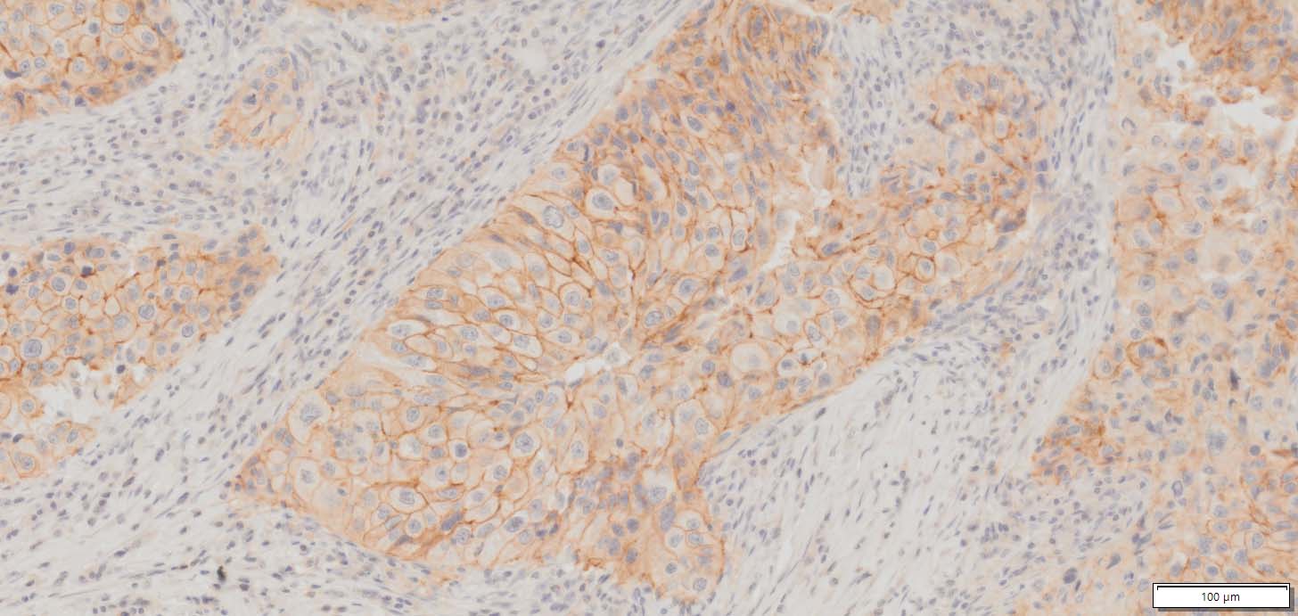 VitroView™ Universal 1-step Polymer-Based IHC kit (anti-Mouse & Rabbit ...