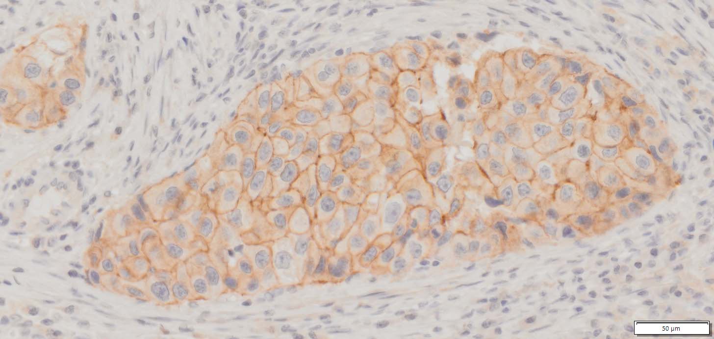 VitroView™ Universal 1-step Polymer-Based IHC kit (anti-Mouse & Rabbit ...