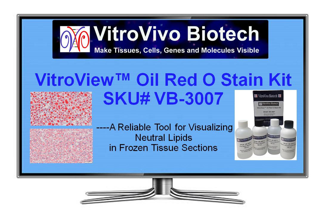 Oil Red O Staining | Stain Kit Online