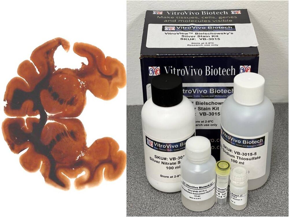 Histochemical Stains | Staining Kits for Routine