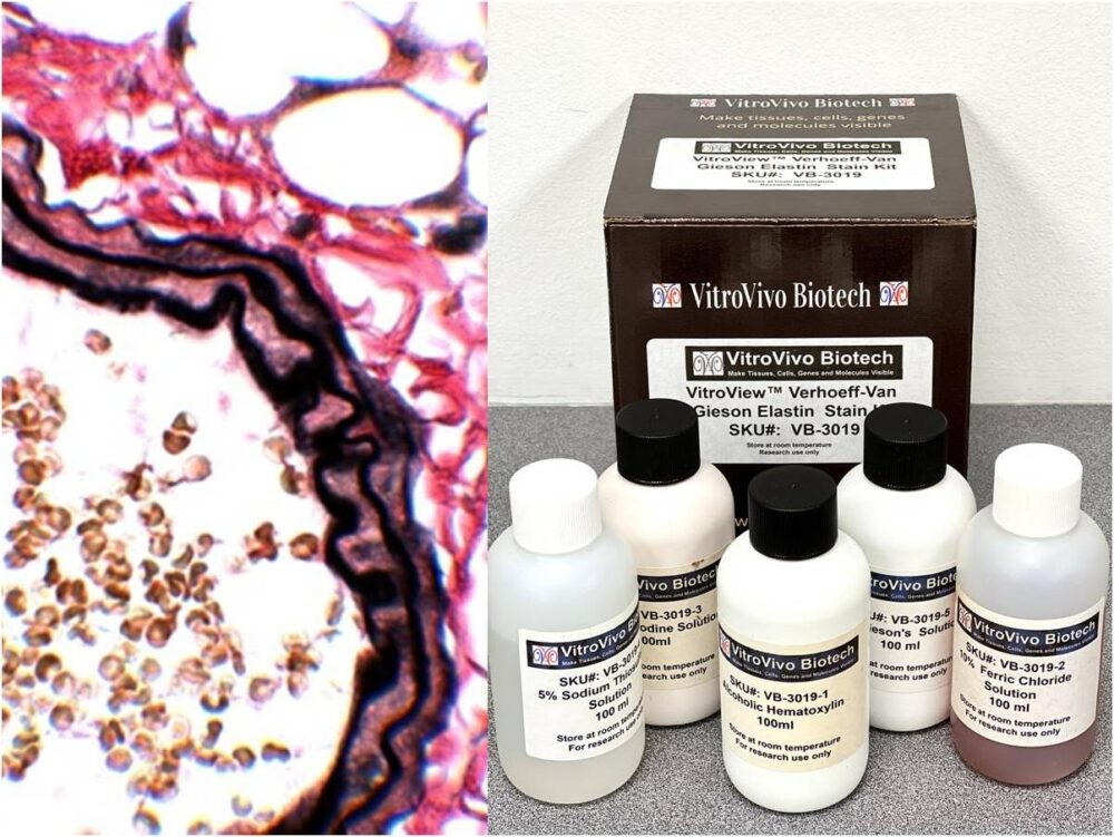 Trichrome Stain for FFPE And Frozen Tissue Slides