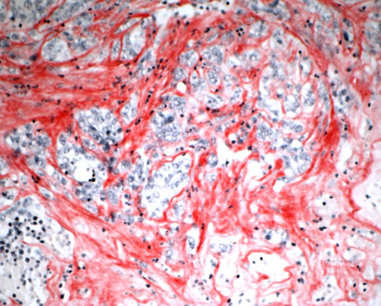 VitroView™ Picro-Sirius Red Stain Kit - VitroVivo Biotech