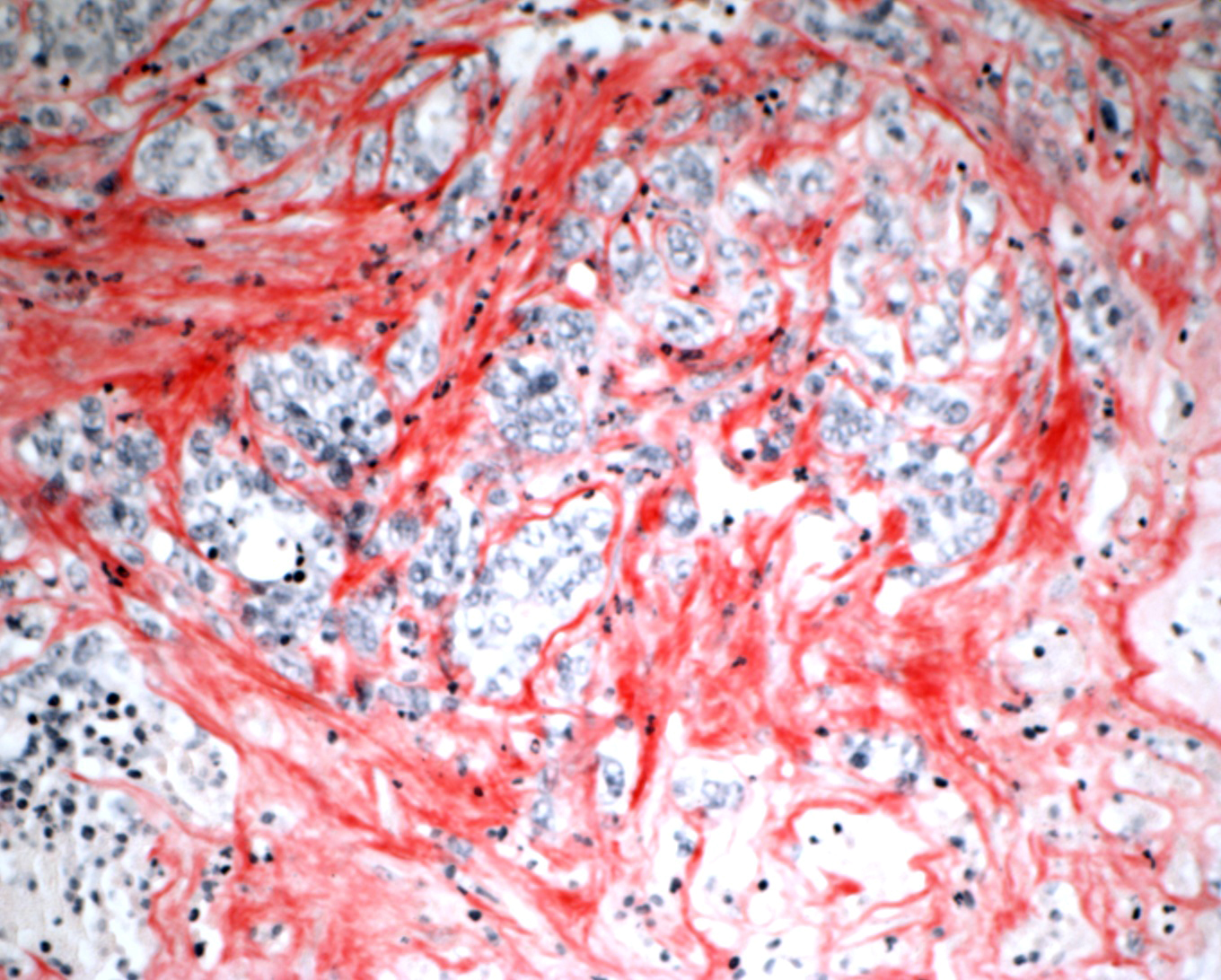 VitroView™ Picro-Sirius Red Stain Kit - VitroVivo Biotech