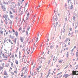 VitroView™ Nissl Stain Kit - Detection of Nissl body in the cytoplasm ...