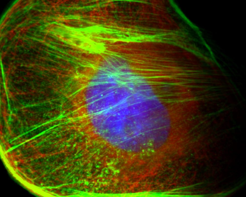 VitroView™ Immunofluorescence Double Staining Kit, FL488 Anti-Mouse ...