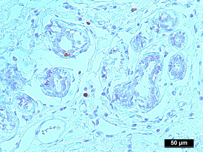 Human Breast Tissue (Normal) FFPE Sections