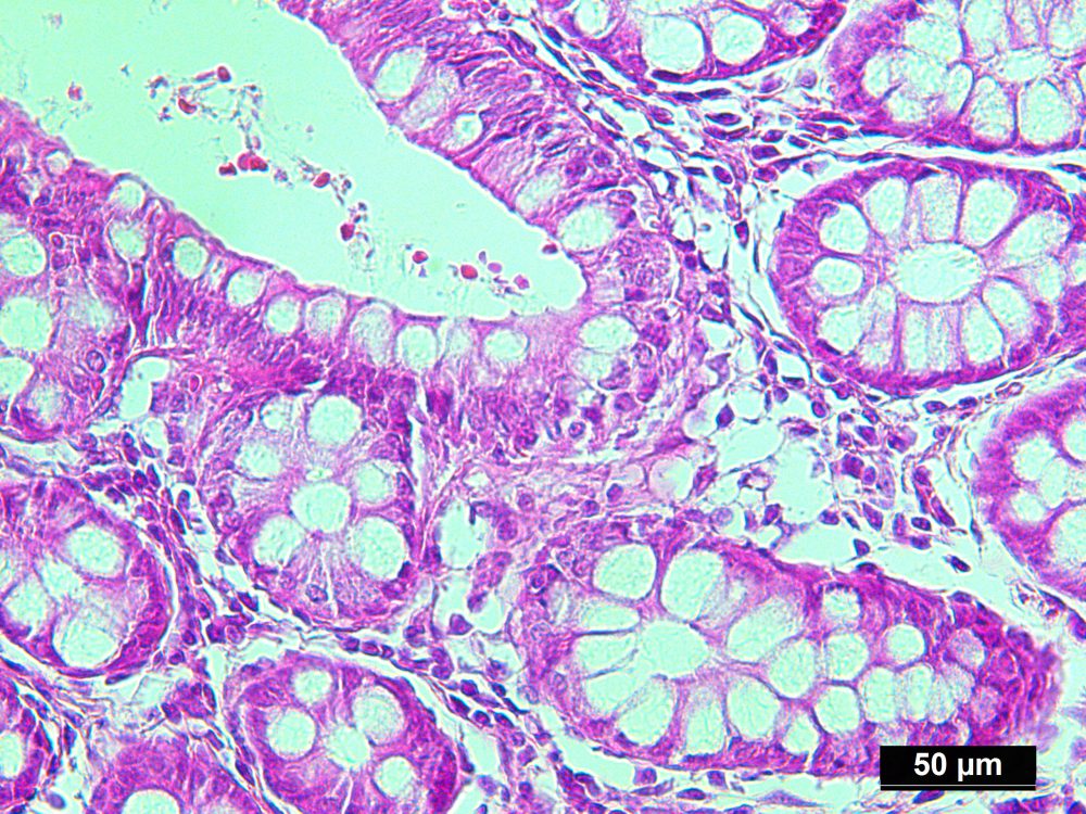 Human Colon Tissue (Normal) FFPE Sections