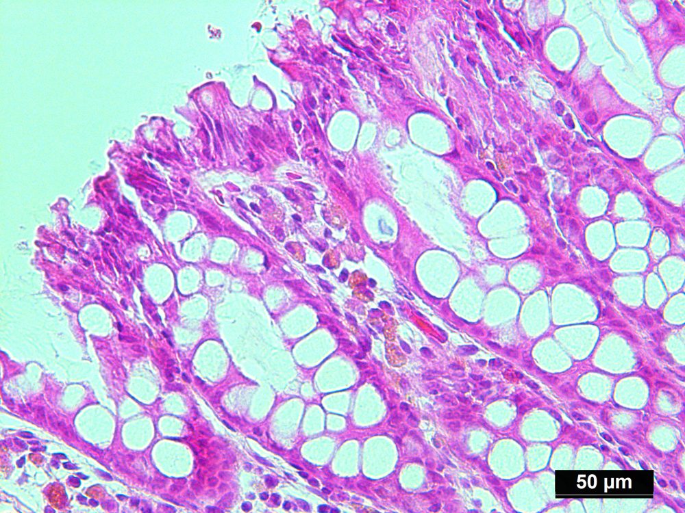 Human Colon Tissue (Normal) FFPE Sections