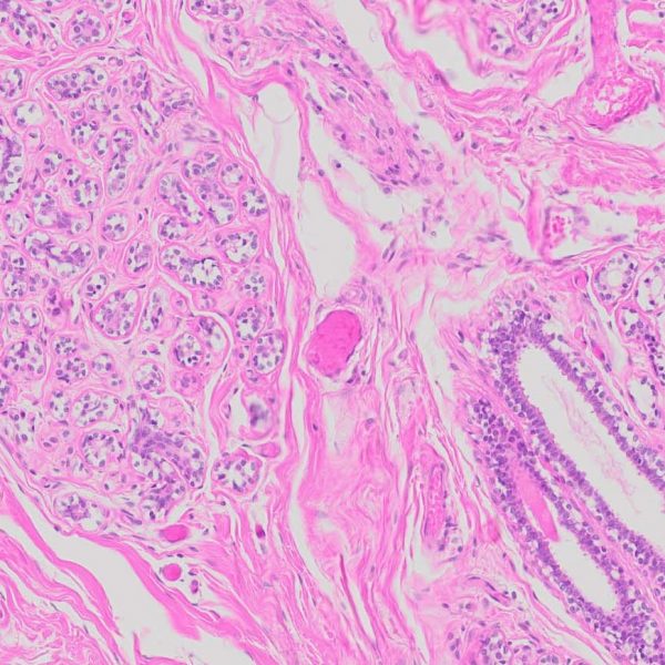 Human Breast Tissue (Normal) FFPE Sections