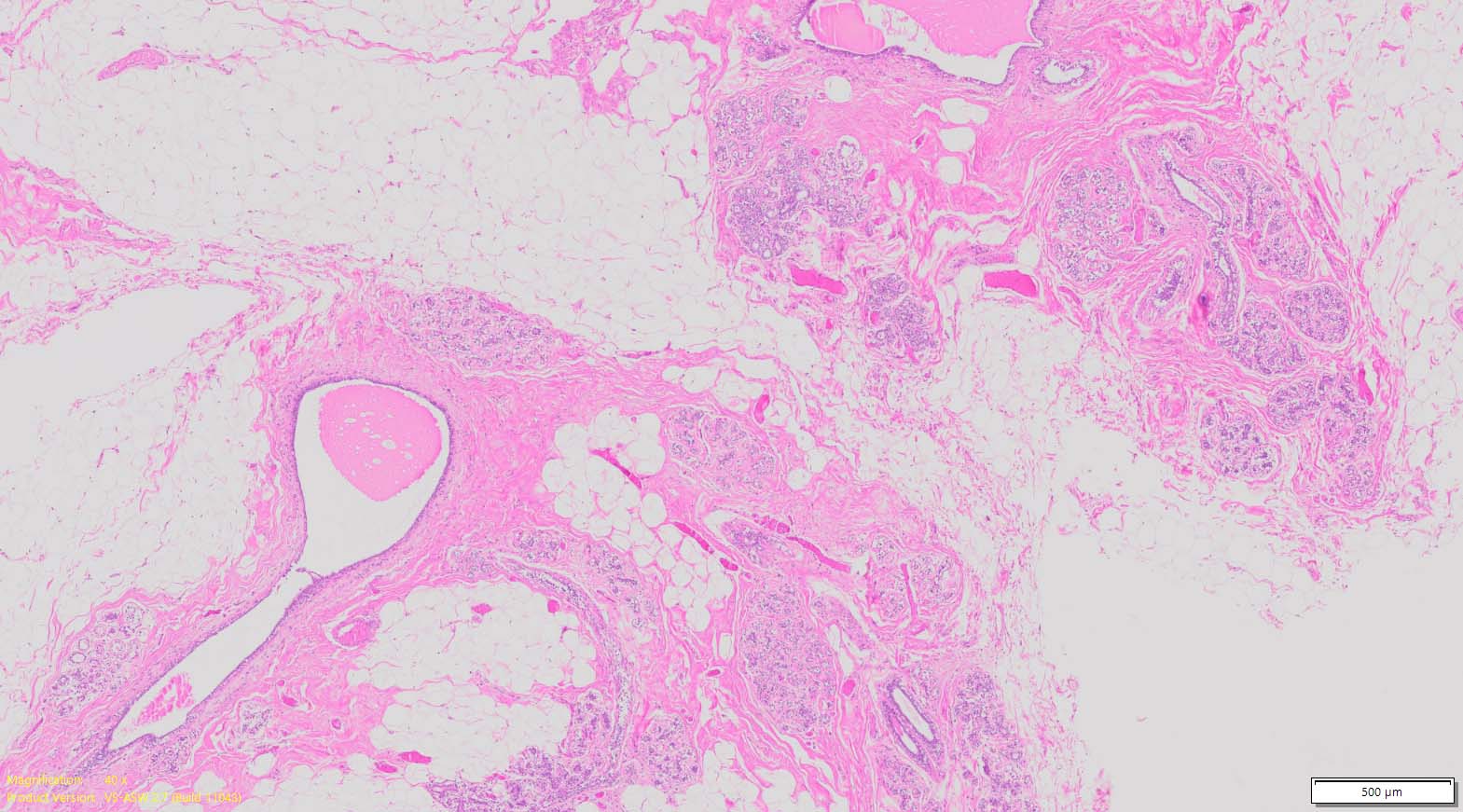 Human Breast Tissue (Normal) FFPE Sections