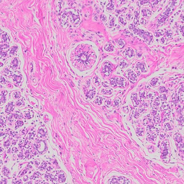 Human Breast Tissue (Normal) FFPE Sections