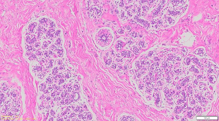 Human Breast Tissue (Normal) FFPE Sections