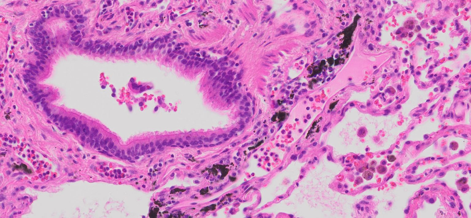 Human Lung Tissue (Non-Tumor) FFPE Sections