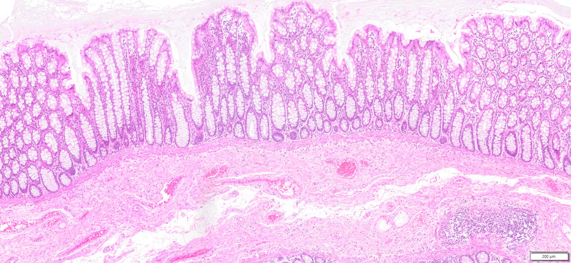 Human Colon Tissue (Normal) FFPE Sections