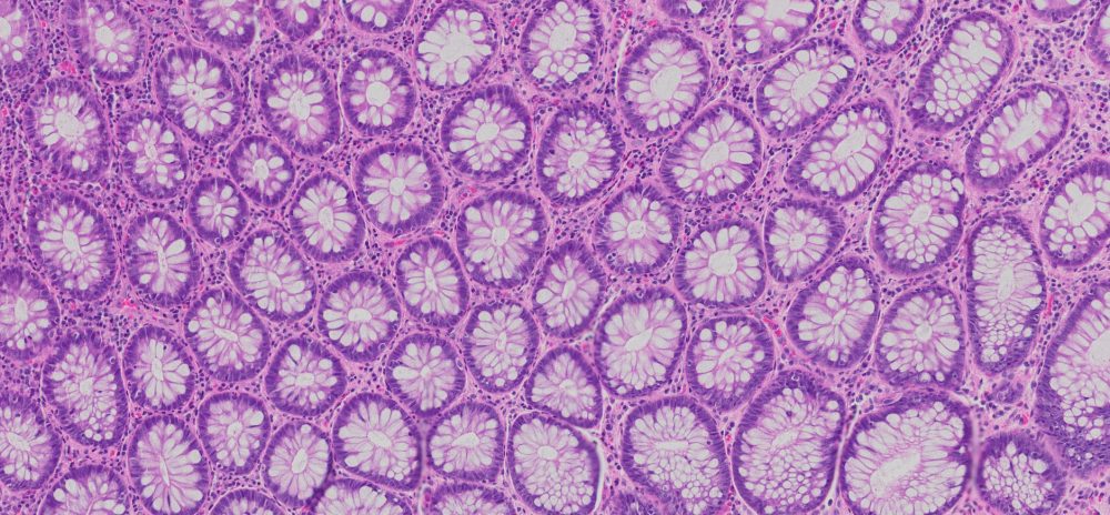 Human Colon Tissue (Normal) FFPE Sections