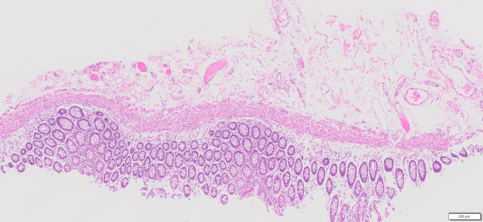 Human Colon Tissue (Normal) FFPE Sections