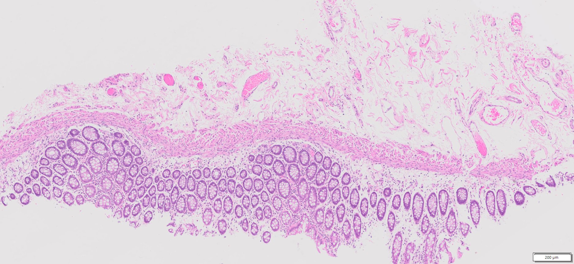 Human Colon Tissue (Normal) FFPE Sections