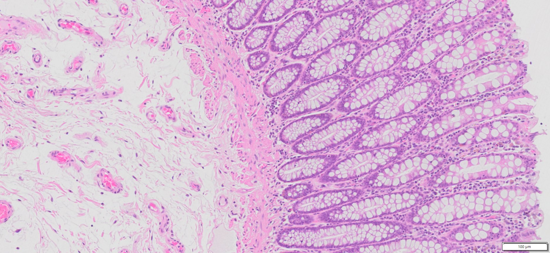 Human Colon Tissue (Normal) FFPE Sections