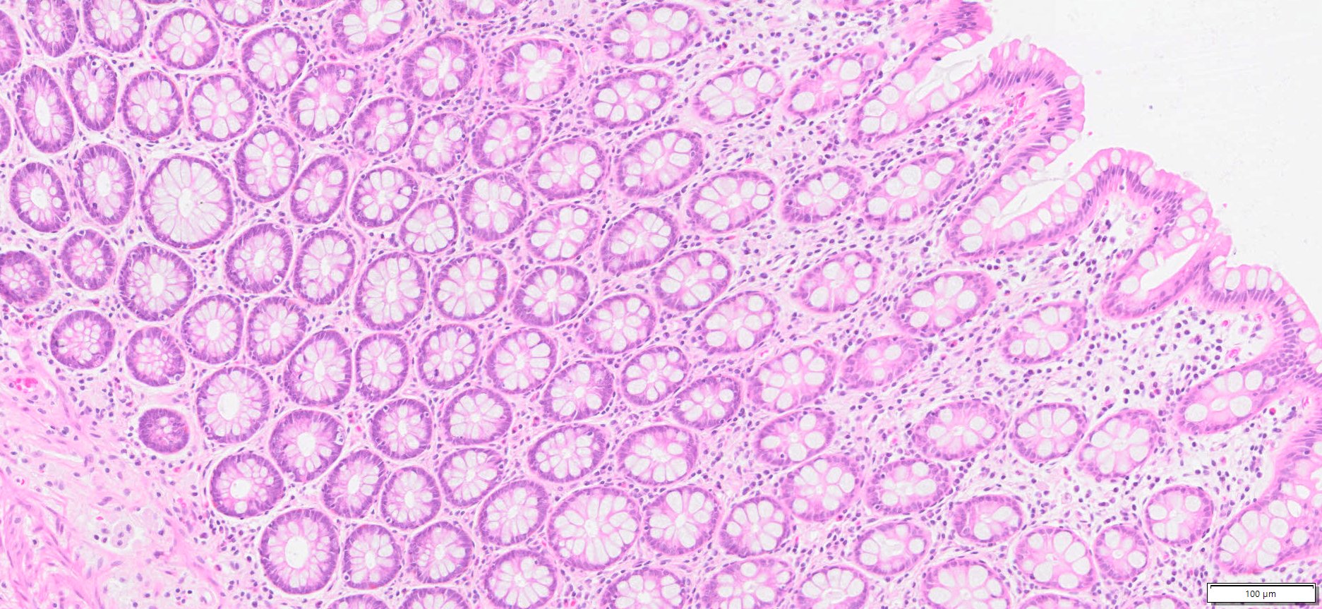 Human Colon Tissue (Normal) FFPE Sections
