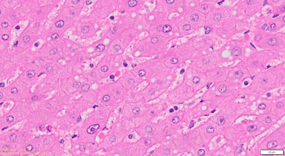 Human Liver Tissue (Normal) FFPE Sections