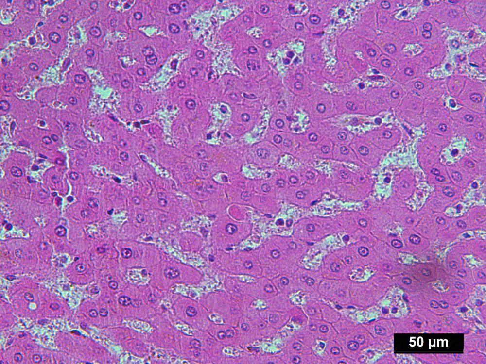 Human Liver Tissue (Normal) FFPE Sections