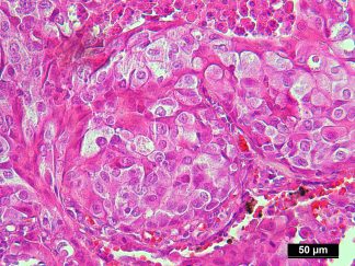 Human Lung Tissue (Normal) FFPE Sections