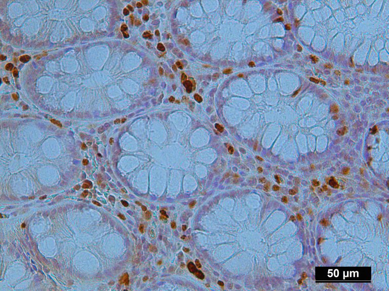 Protein Lysate of Pure Human Colon Normal Tissue Cells Cells Isolated ...