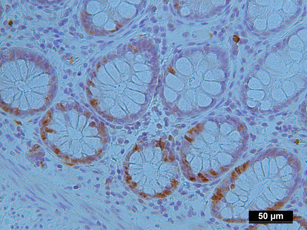 Genomic DNA Extracted from Pure Human Colon Normal Tissue Cells ...