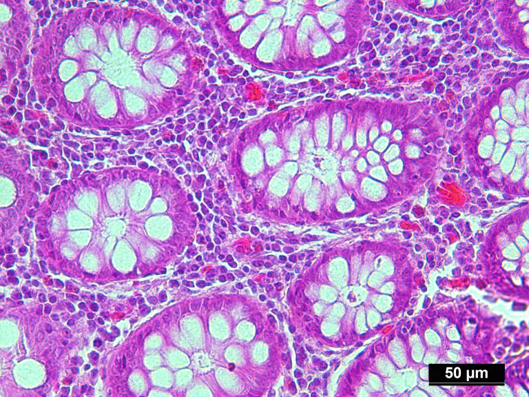 Pure Human Normal Colon Gland Epithelium Isolated by LCM from FFPE Sample