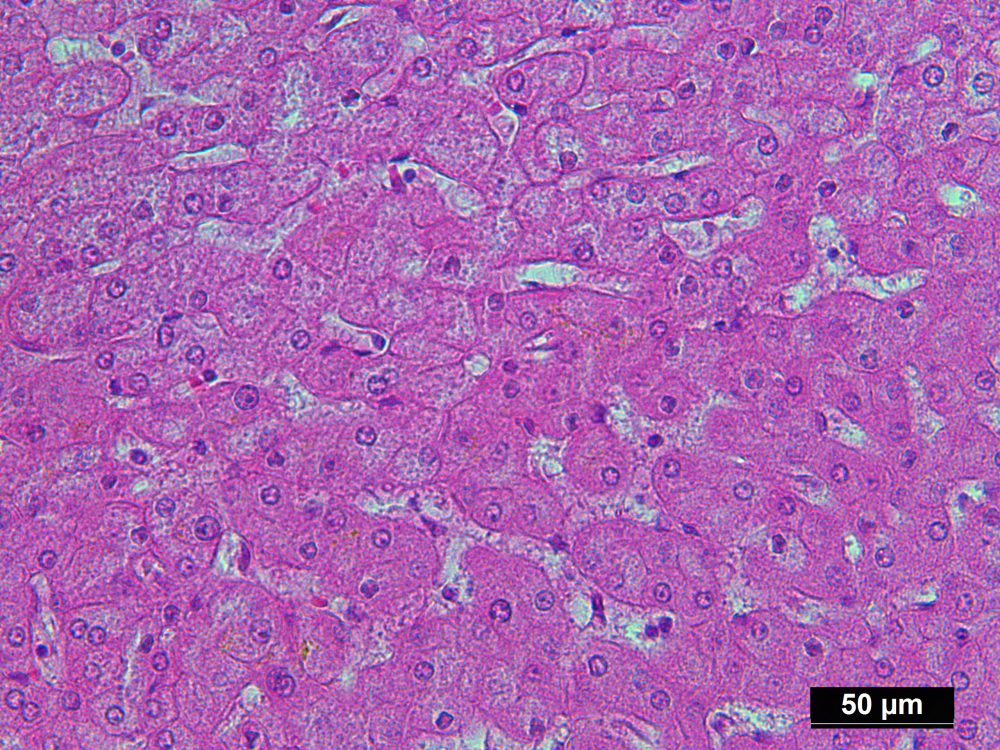 Genomic DNA Extracted from Pure Human Liver Cancer Cells Isolated by ...