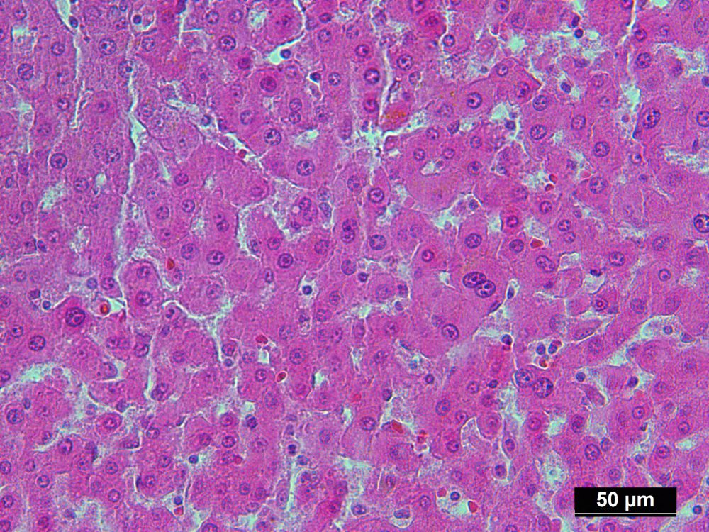 Protein Lysate of Pure Human Liver Normal Cells Isolated by LCM from FFPE Sample