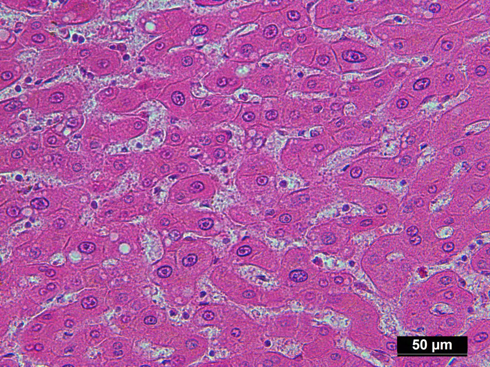 Pure Human Normal Hepatocytes Isolated by LCM from FFPE Sample