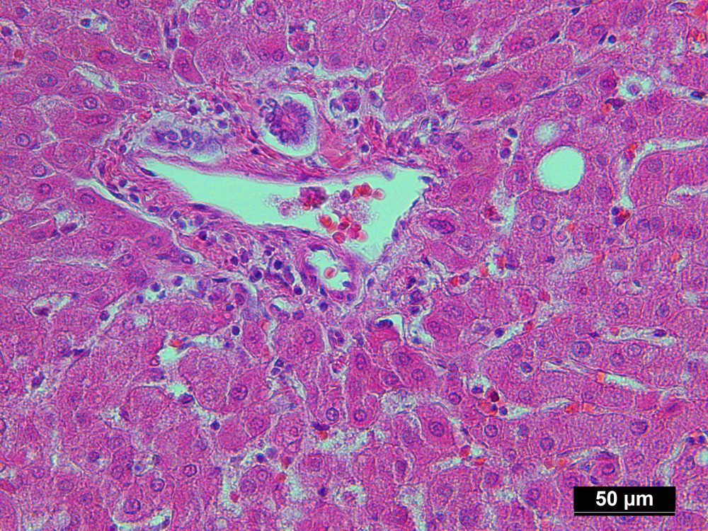 Pure Human Normal Hepatocytes Isolated by LCM from FFPE Sample