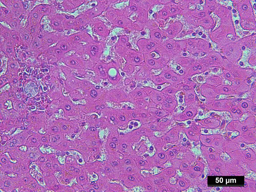 Pure Human Normal Hepatocytes Isolated by LCM from FFPE Sample