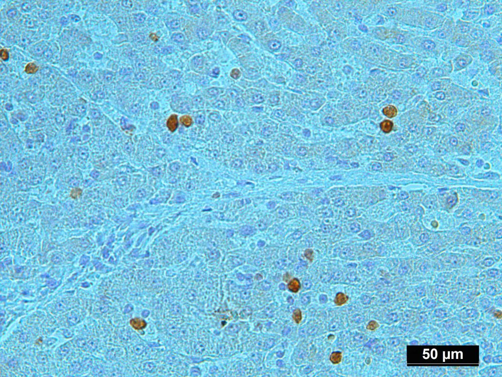 Pure Human Normal Hepatocytes Isolated by LCM from FFPE Sample
