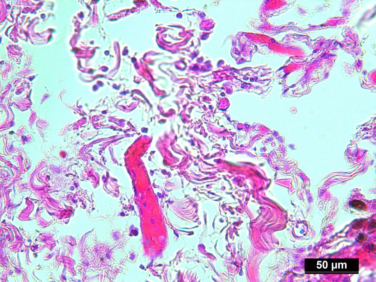 Genomic DNA Extracted from Pure Human Normal Lung Alveolar Cells ...