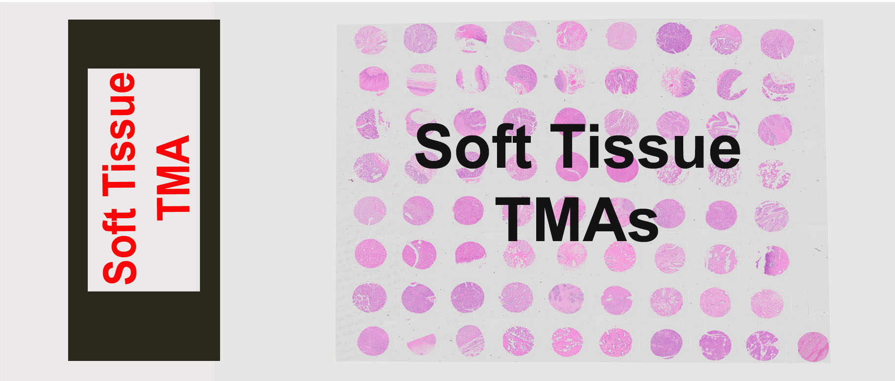 Soft Tissue Arrays