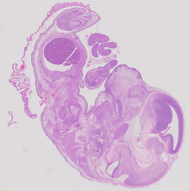 Mouse Whole Embryo (E13.5) Paraffin Sagittal Sections (1 section/slide ...