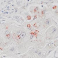 VitroView™ Alcian Blue Stain Kit