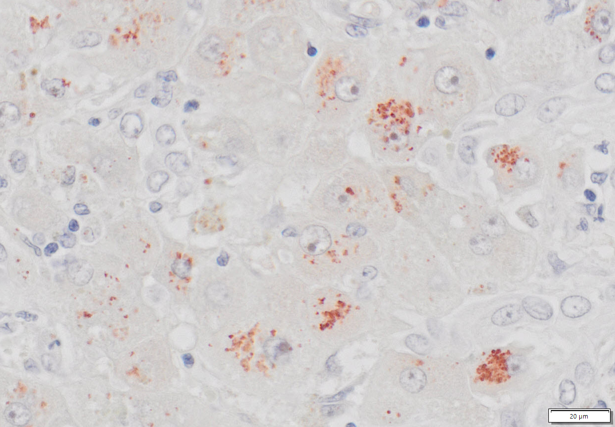 VitroView™ Rhodanine Copper Stain Kit
