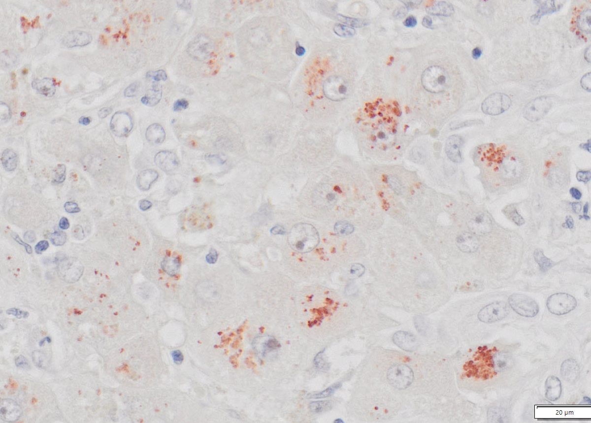 VitroView™ Rhodanine Copper Stain Kit (small size)