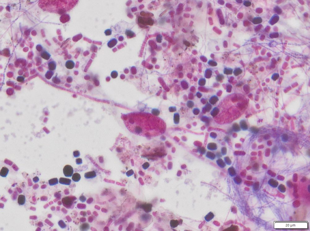 VitroView™ Differential Quik Stain Kit