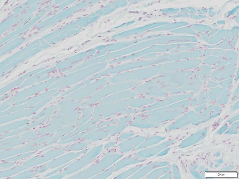 VitroView™ Twort's Counterstain Kit