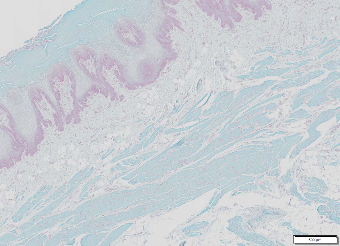 VitroView™ Twort's Counterstain Kit
