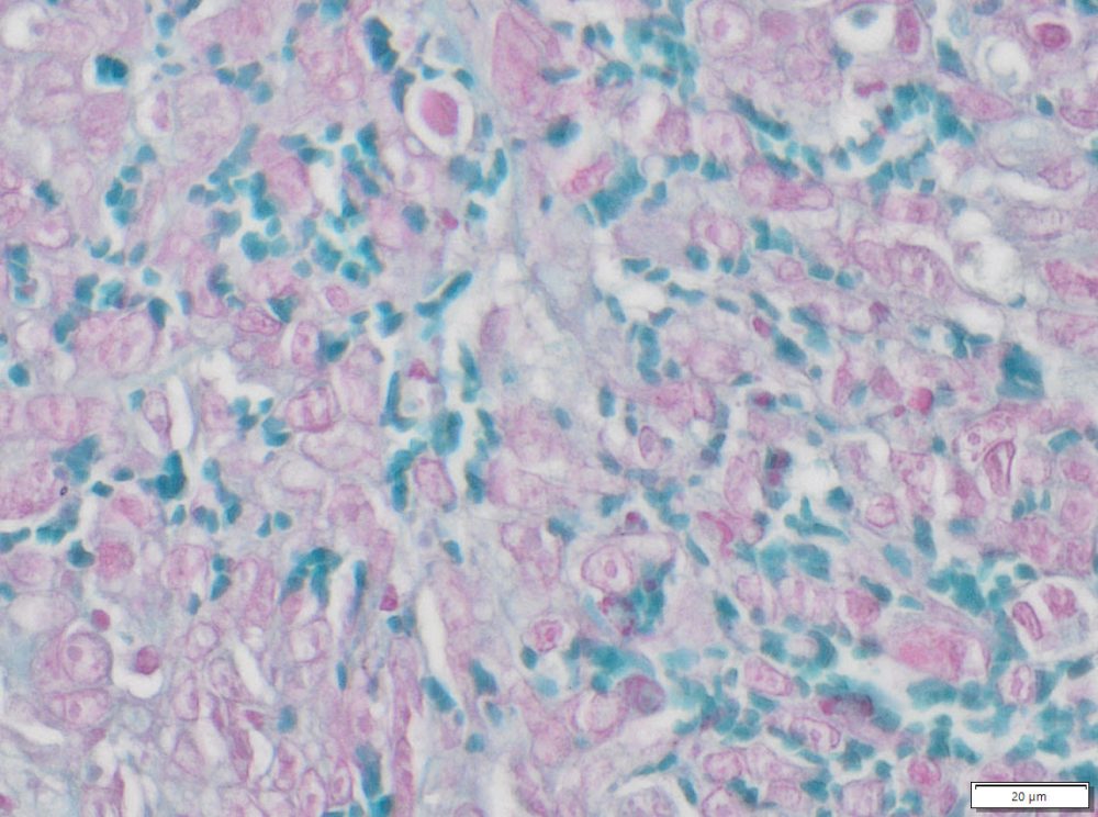 VitroView™ Twort's Counterstain Kit