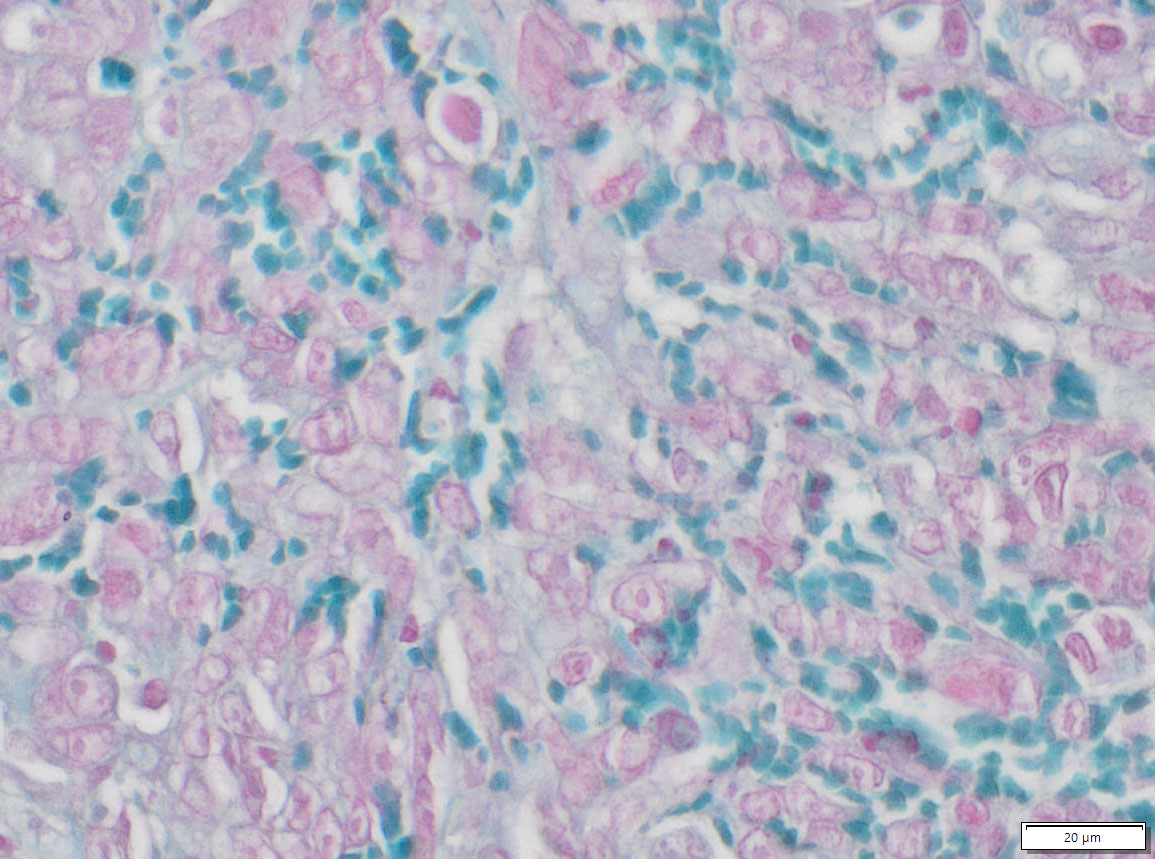 VitroView™ Twort's Counterstain Kit