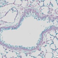 VitroView™ Gram Stain Kit for Slide Smear (250 ml per bottle)