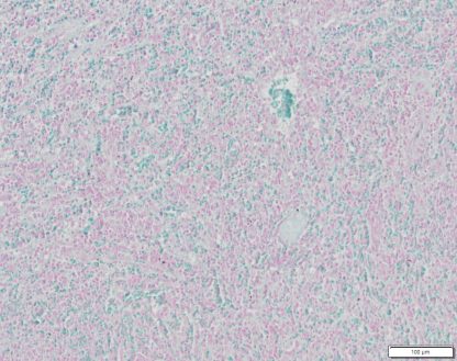 VitroView™ Twort's Counterstain Kit