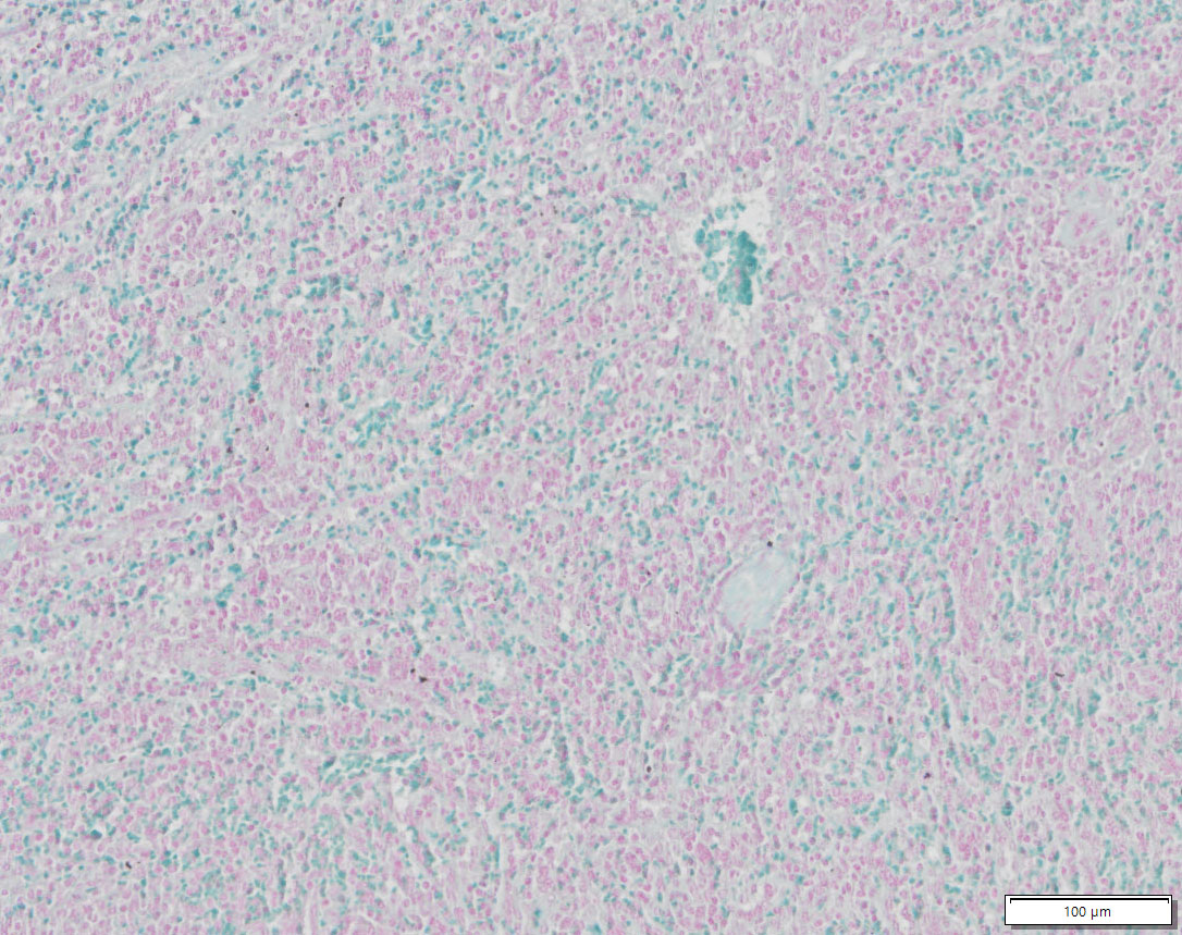 VitroView™ Twort's Counterstain Kit